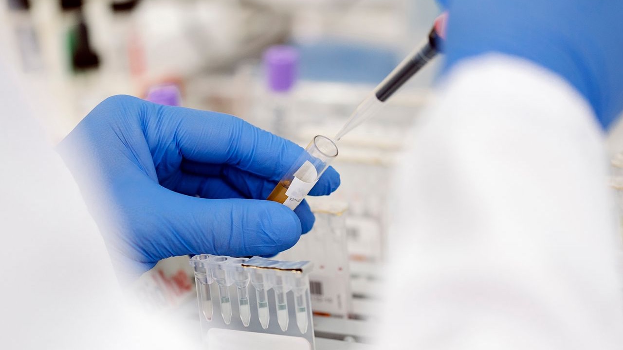 Mujer con VIH se ha curado: es la tercera persona en el mundo que ha ...